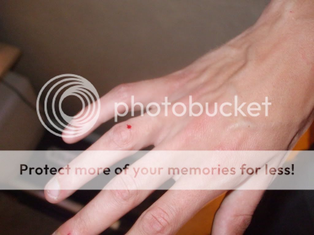 Super Gory Retic Bite Pics... Not for the Faint Hearted | Reptile Forums